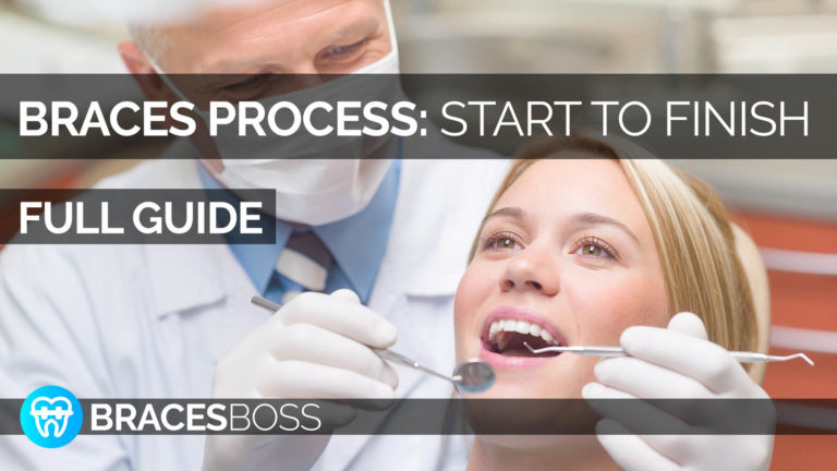 Braces Process - Full Pro Guide 2025 - BracesBoss